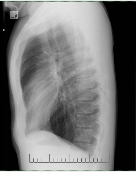 Appointment with the Dr after coughing up blood... - The Fishing ...